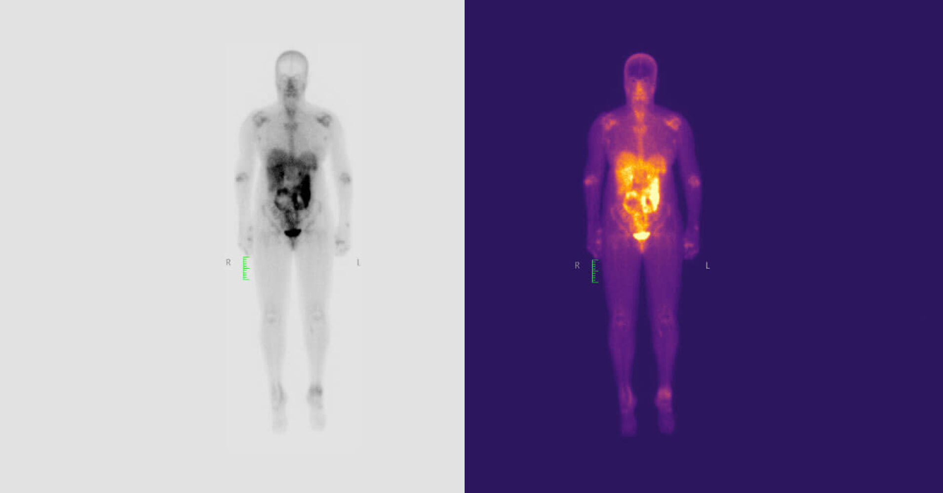 Serac Healthcare | Breakthrough Molecular Imaging